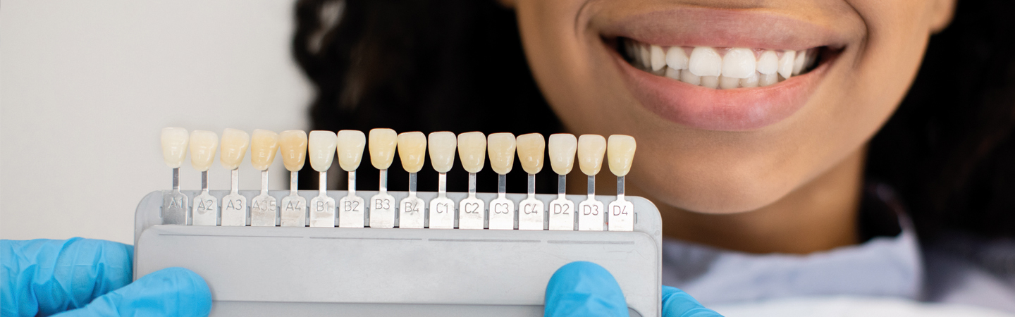 Anterior Composite Tips and Tricks - iLearn